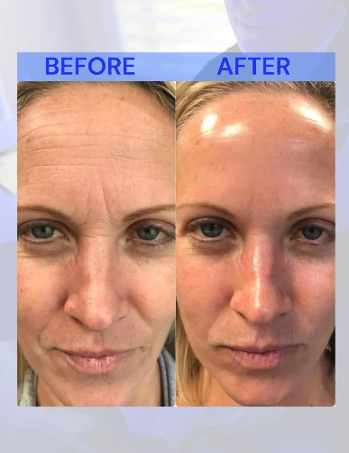 Gallery | Ultra Cryo & Recovery Auburndale | Polk County, FL