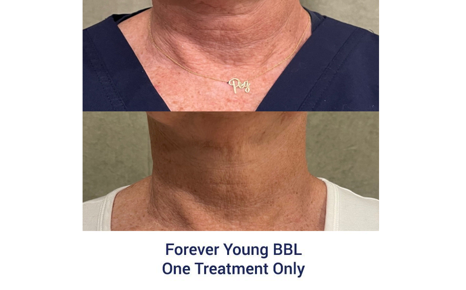 Island Plastic Surgery & Aesthetic Center Before and After Photo Gallery
