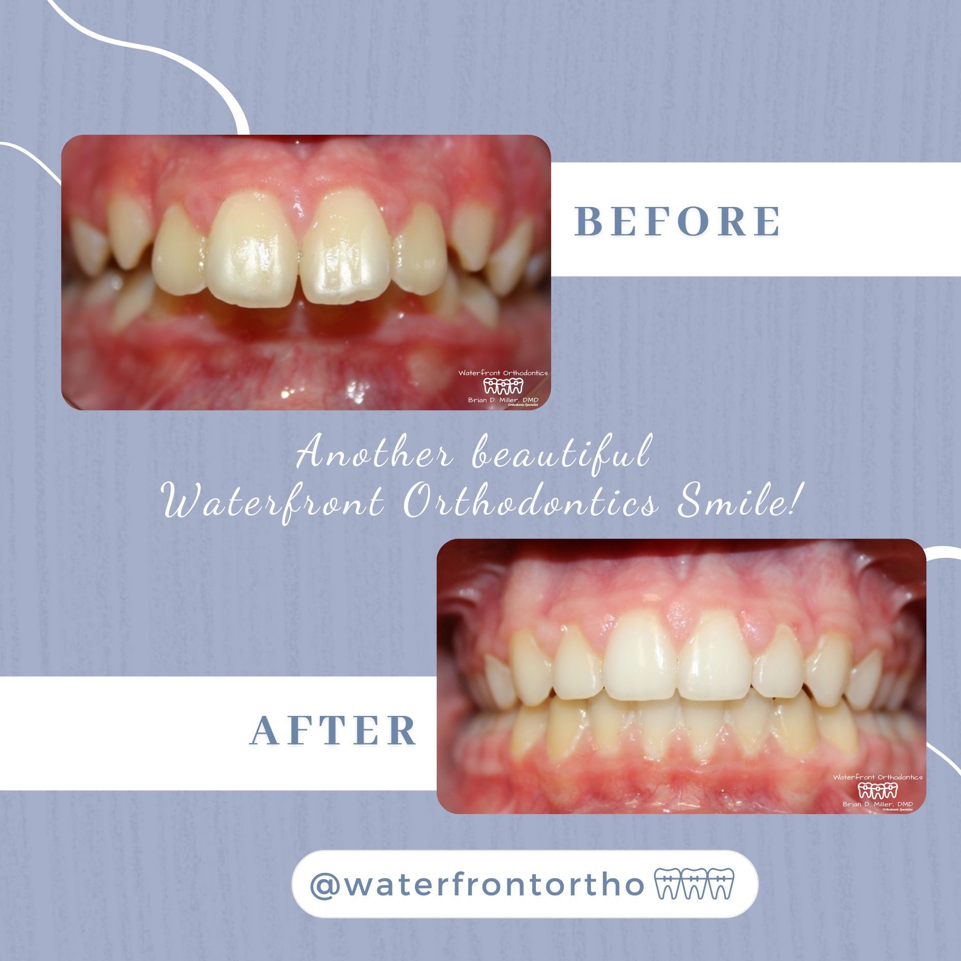 Brian D Miller DMD Smile Gallery | Plains, PA