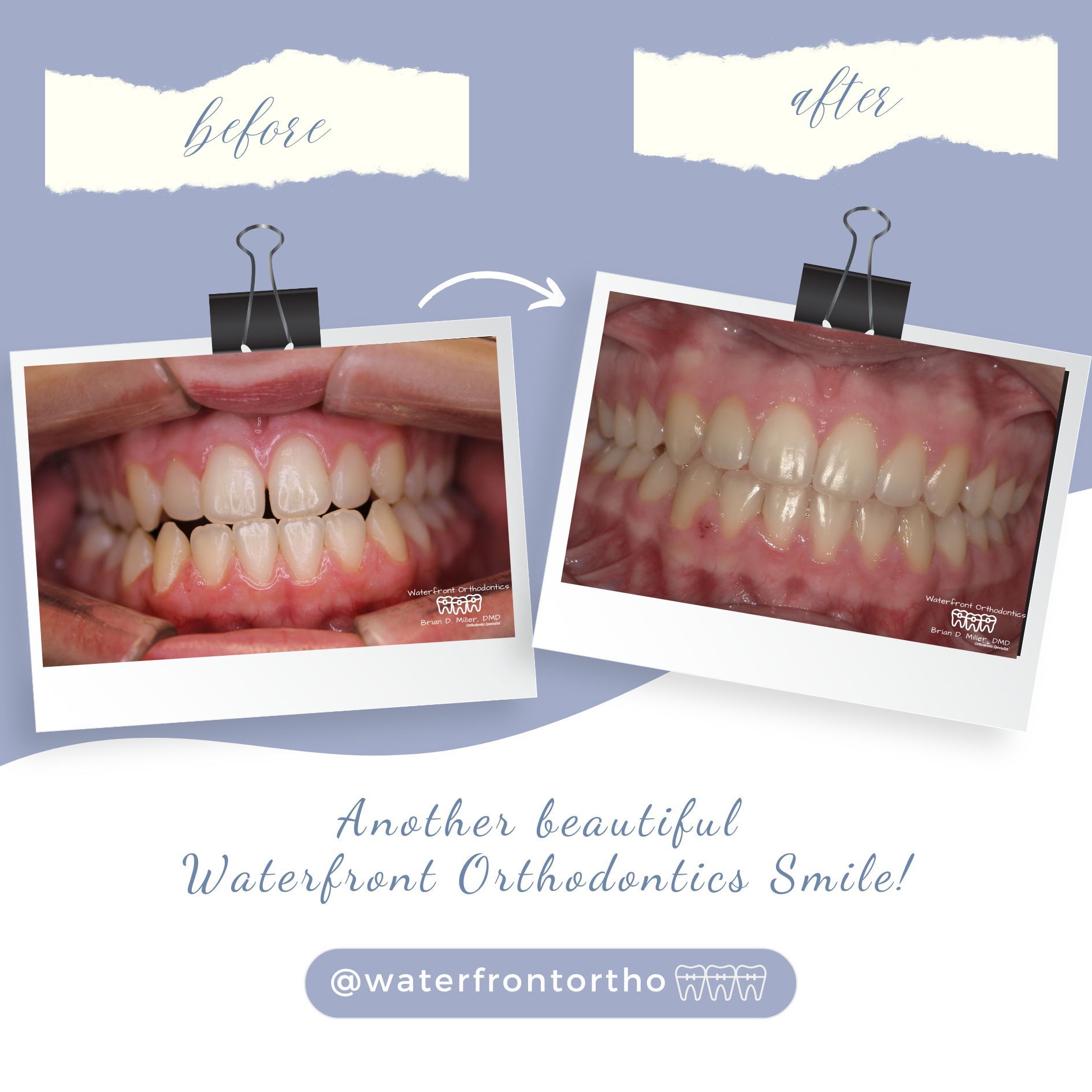 Brian D Miller DMD Smile Gallery | Plains, PA