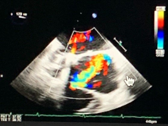 TTE Tests | TEE Tests | Carlsbad, NM