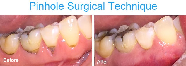 North Mississippi Periodontics and Implant Dentistry Photos Tupelo
