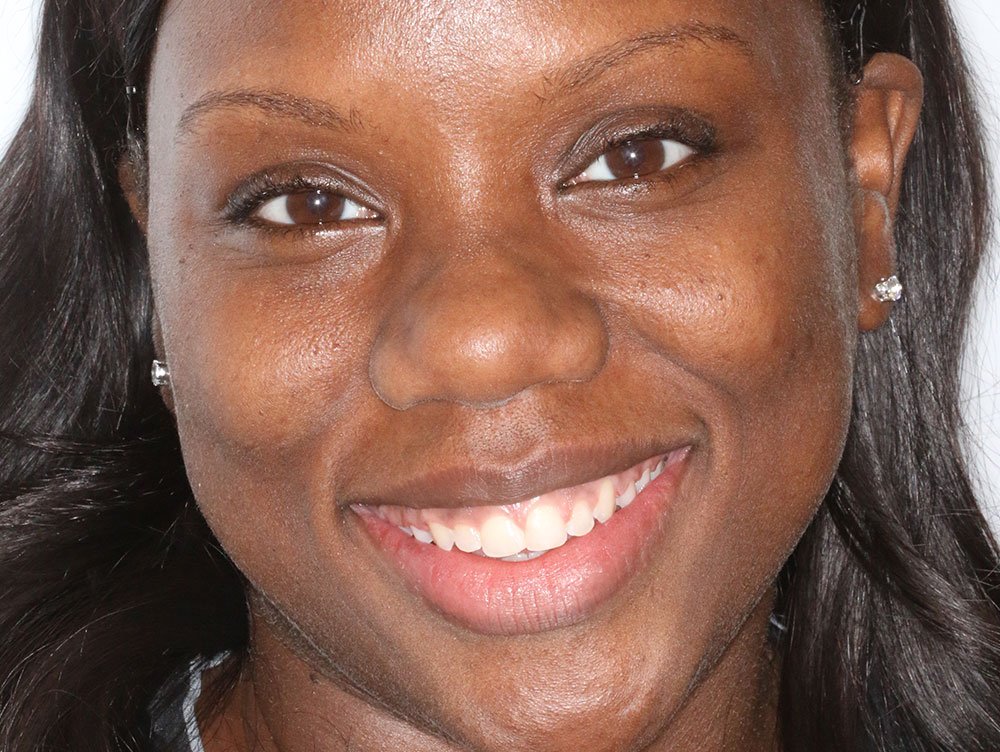 The Winning Smile Dental Group | Exams | Brandon, MS